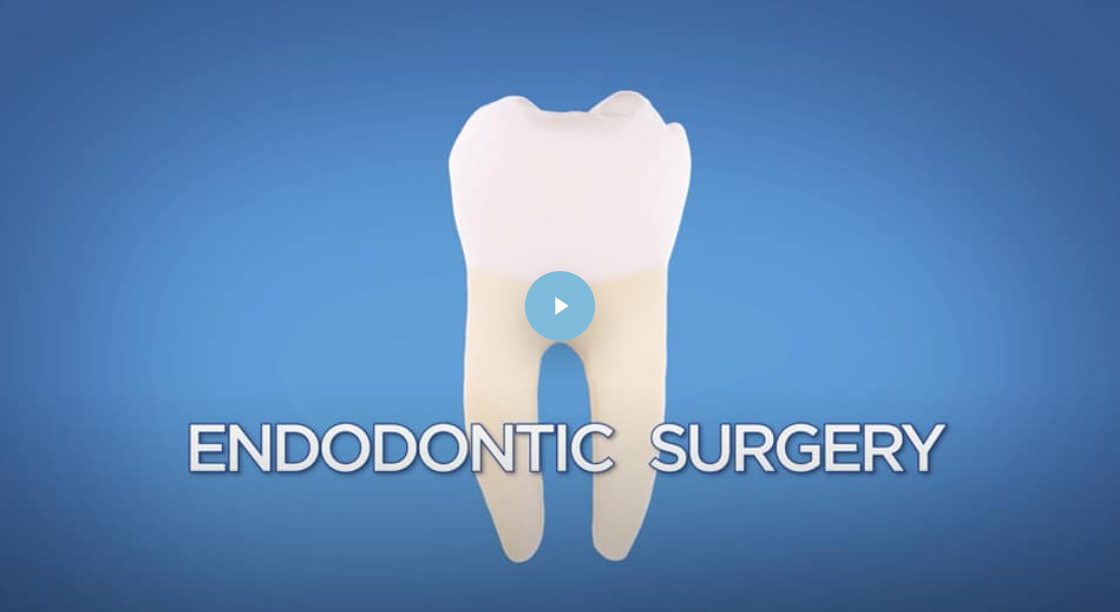 Endodontic Surgery - Endodontic Specialist Dr. Dijana Elmejdoubi DDS, MS